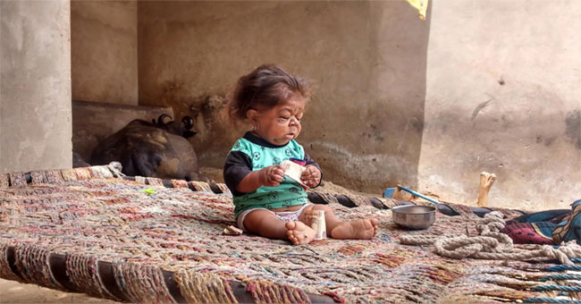 Chàng trai 23 tuổi mắc kẹt trong hình hài của “cậu bé tí hon” - KhoaHoc.tv