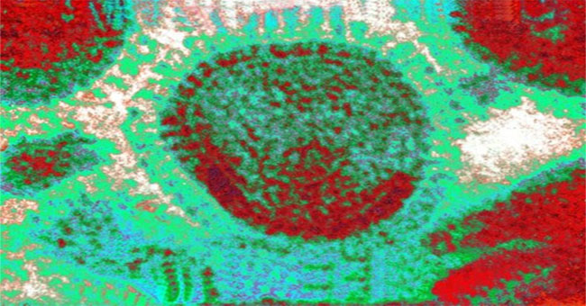 Quan sát được mánh khóe tấn công tế bào của virus cúm - KhoaHoc.tv