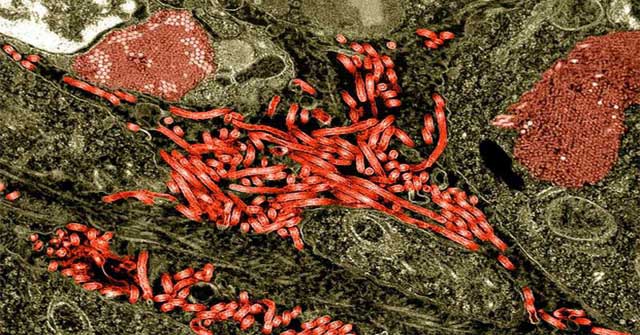 Nhật Bản vừa quyết định nhập khẩu... Ebola và rất nhiều virus chết ...