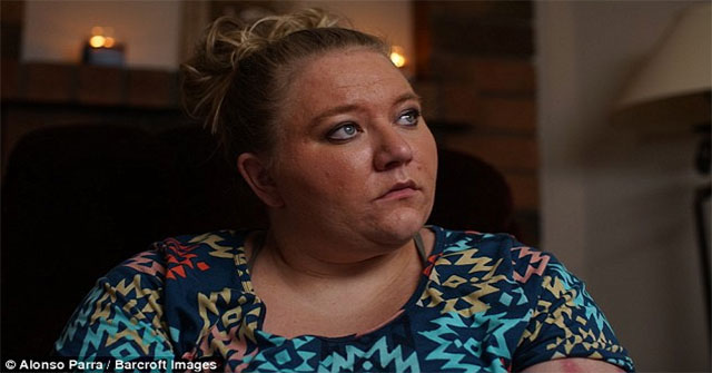 Người phụ nữ mắc căn bệnh đau đớn nhất thế giới - KhoaHoc.tv